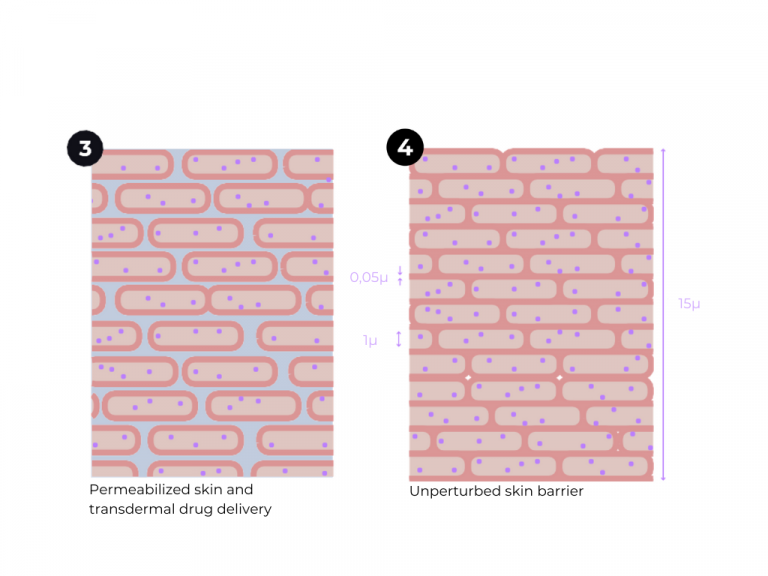 The technology – Ealing Aesthetics